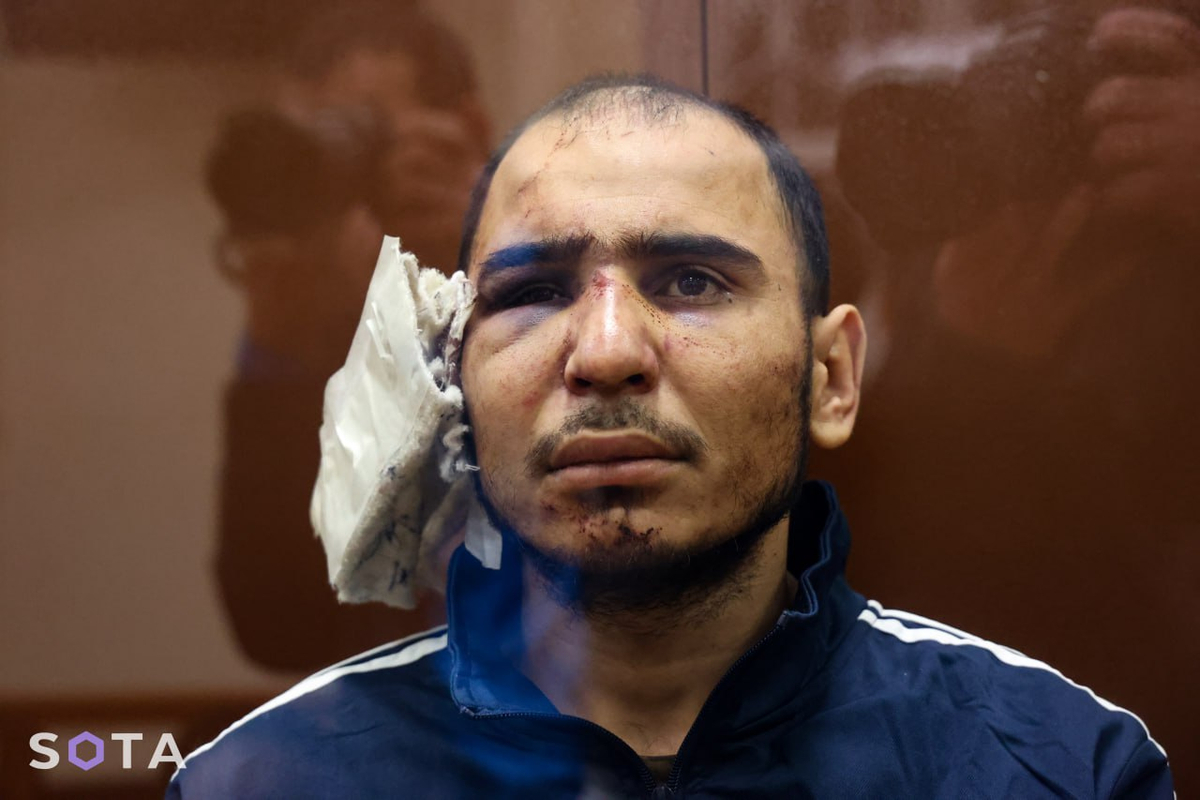 GRAPHIC Photo Shows Moscow Attack Suspect With Pants Down Wired To GRAPHIC Photo Shows Moscow Attack Suspect With Pants Down Wired To